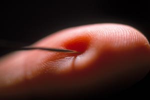 Medical students don’t always report needle injuries | TIME.com