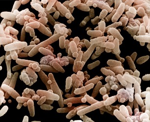 Could Bugs in the Gut Be the Gateway to Colon Cancer? | TIME.com