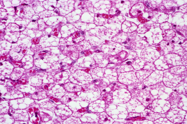 How Now, Brown Fat? Scientist Are Onto a New Way to Lose Weight | TIME.com