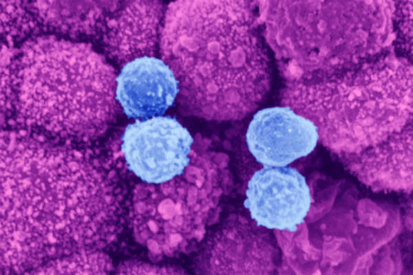 Breast Cancer: Not One Disease but 10, Researchers Say | TIME.com