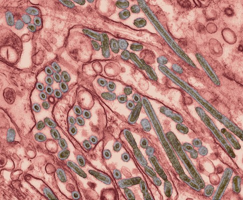 Scientists Push to Resume Research On Virulent Man-Made Flu Virus ...